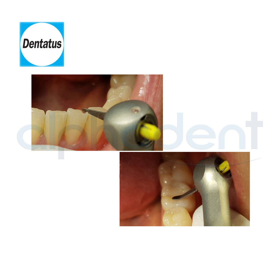 Dentatus – Alphadent Corporation